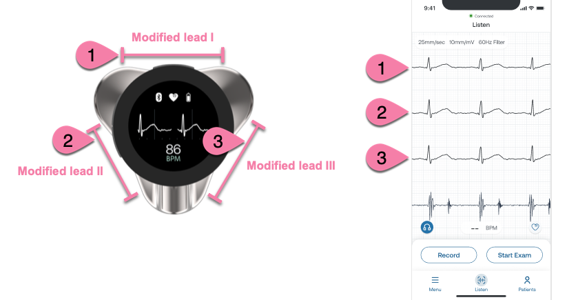 Capture sounds and ECG with the CORE 500™ – Eko SENSORA Help Center