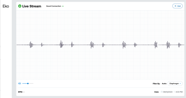Initiate a live stream – Eko SENSORA Help Center