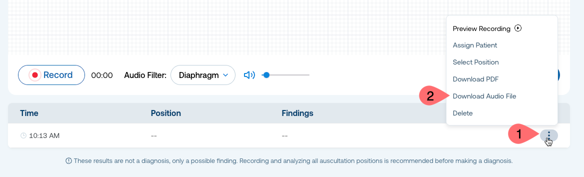 Take and manage recordings on the Eko Dashboard – Eko SENSORA Help Center