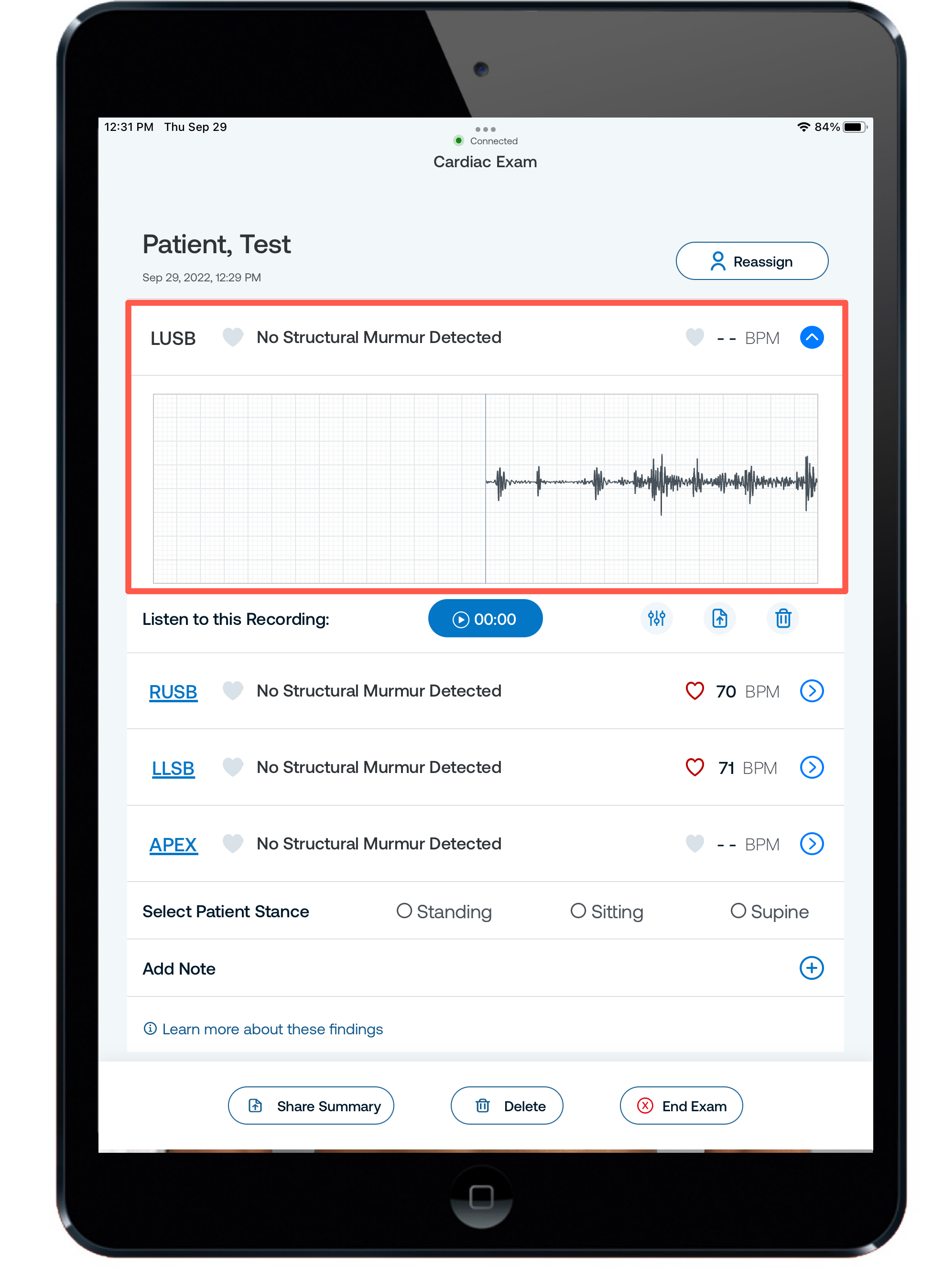 Take a full cardiac exam on the Eko App – Eko SENSORA Help Center