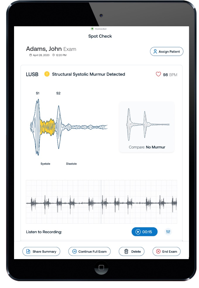 Take a full cardiac exam on the Eko App – Eko SENSORA Help Center