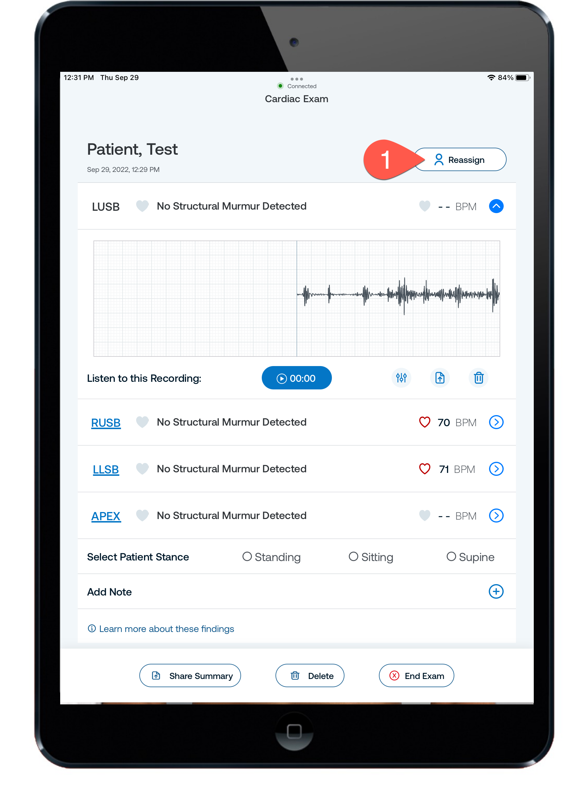 Take a full cardiac exam on the Eko App – Eko SENSORA Help Center