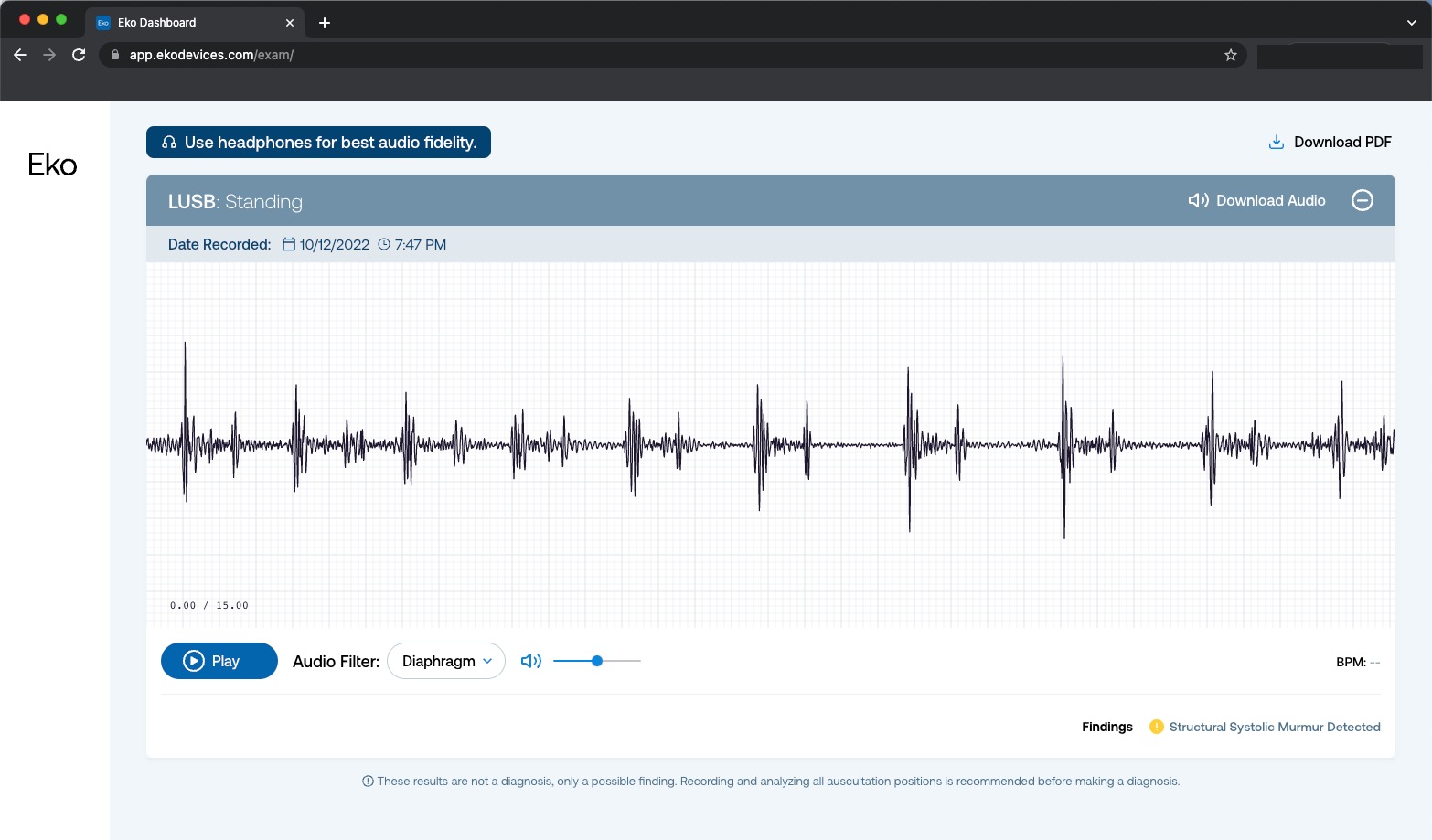 Take a full cardiac exam on the Eko App – Eko SENSORA Help Center